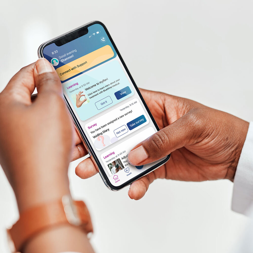 Neuromodulation UUI Therapy Device | BlueWind Revi